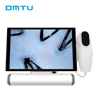 Usb Digital Hair Transplant Microscope Dermatoscope Camera 3d Scalp ...
