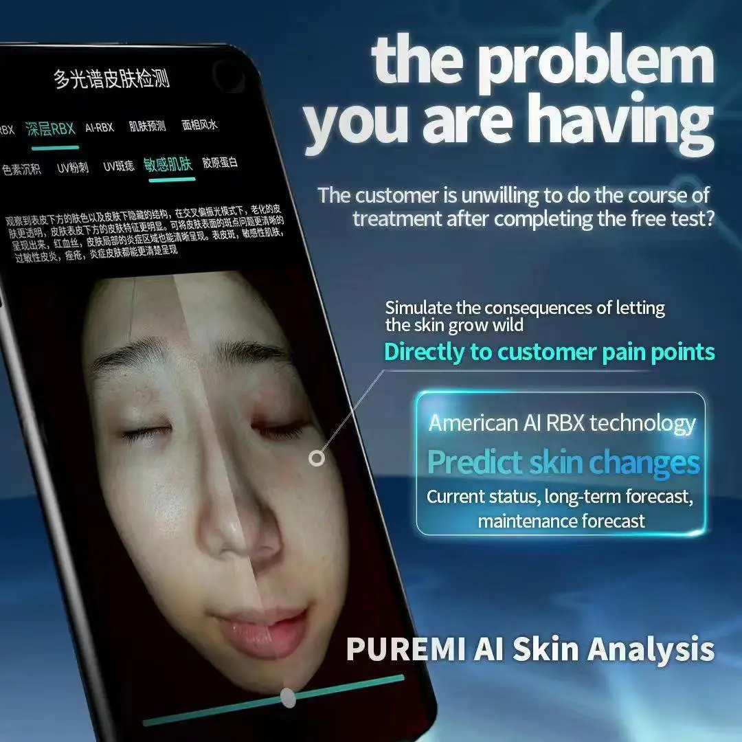 2024 Hot 3d Skin Analyzer M12 Microscope Lens For Visia Skin Analysis ...