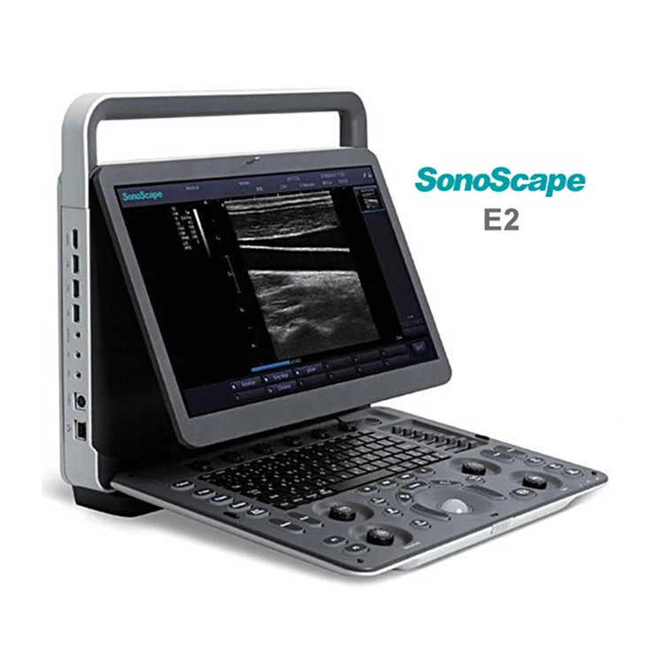Sonoscape E2 Ultrasound Machine - Portable and Versatile