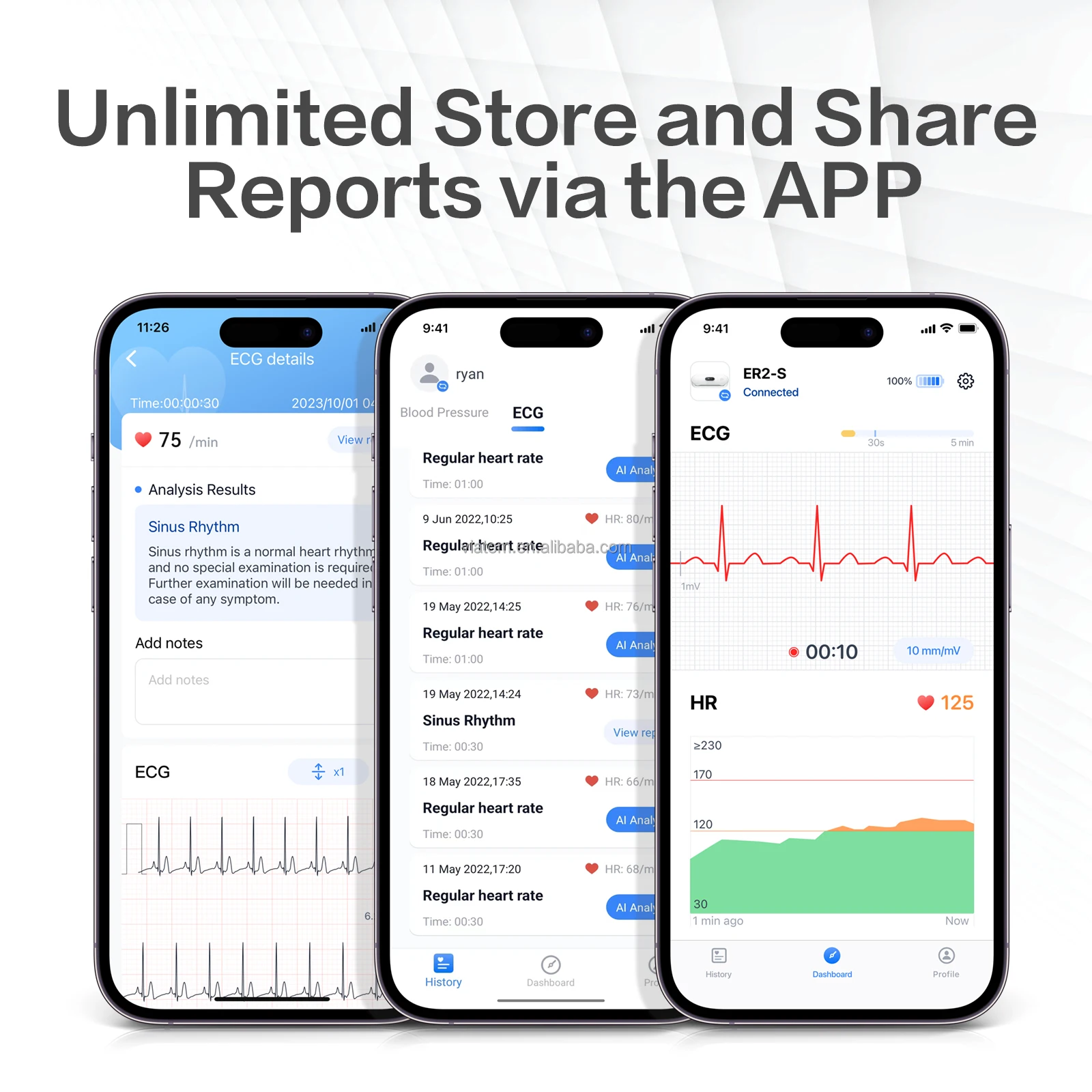Wellue Telemedicine ECG Diagnostic Device - Real-Time Tracking