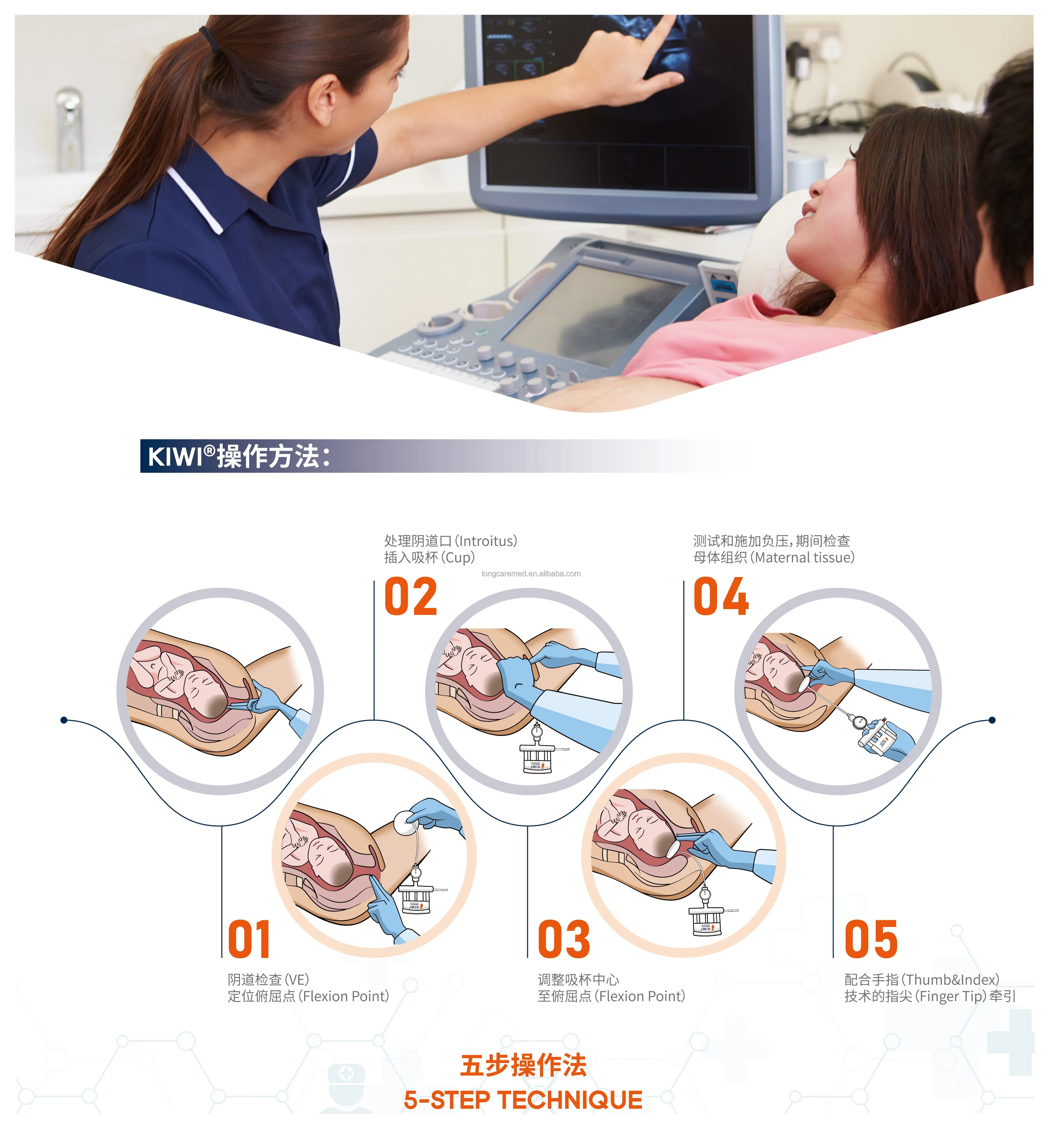Fetal Scalp Vacuum Delivery System - Obstetric Suction Cup