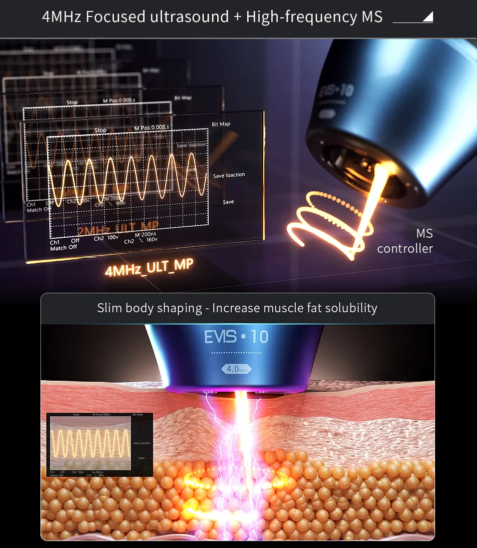 MPTS hifu 12D - vivalaser for you for all for beauty