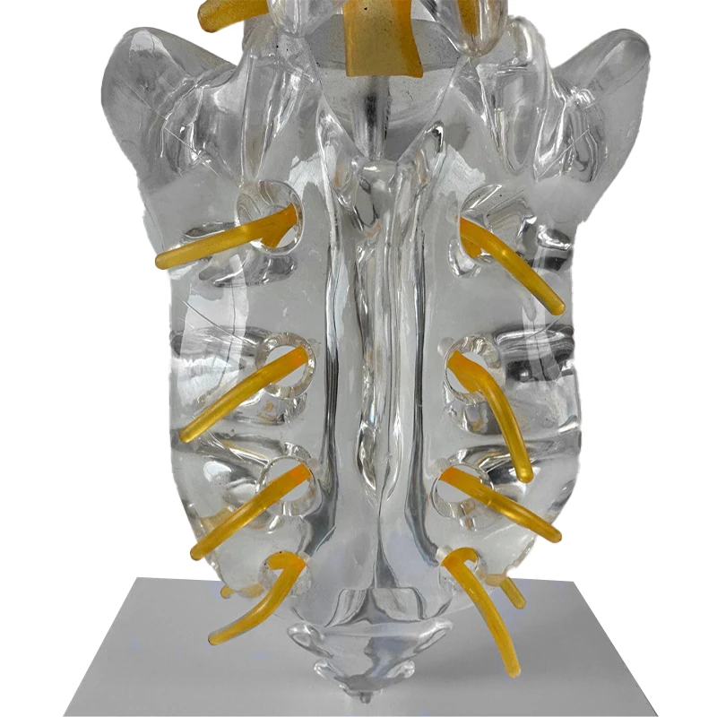Transparent Lumbar Spine With Tailbone Model Intervertebral Disc,Spinal ...