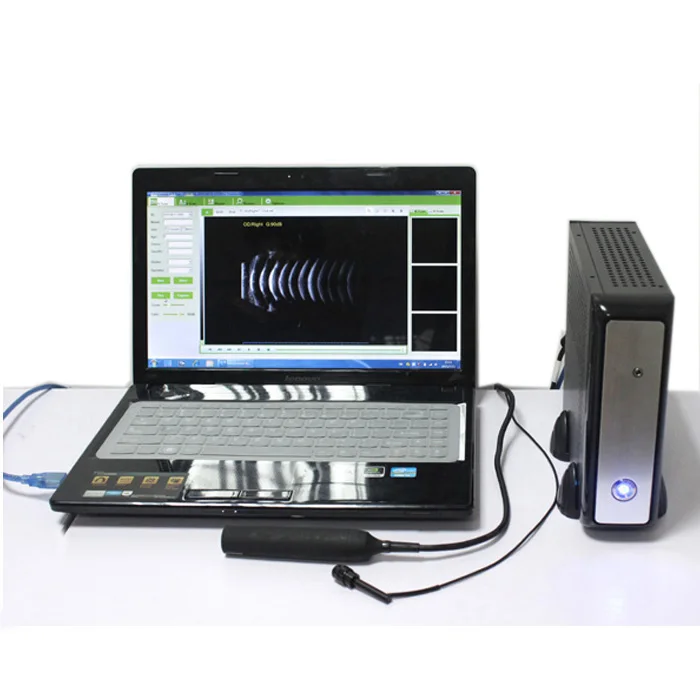 CAS-2000B+ China Ophthalmic AB Scan: Advanced Ultrasound for Eye ...