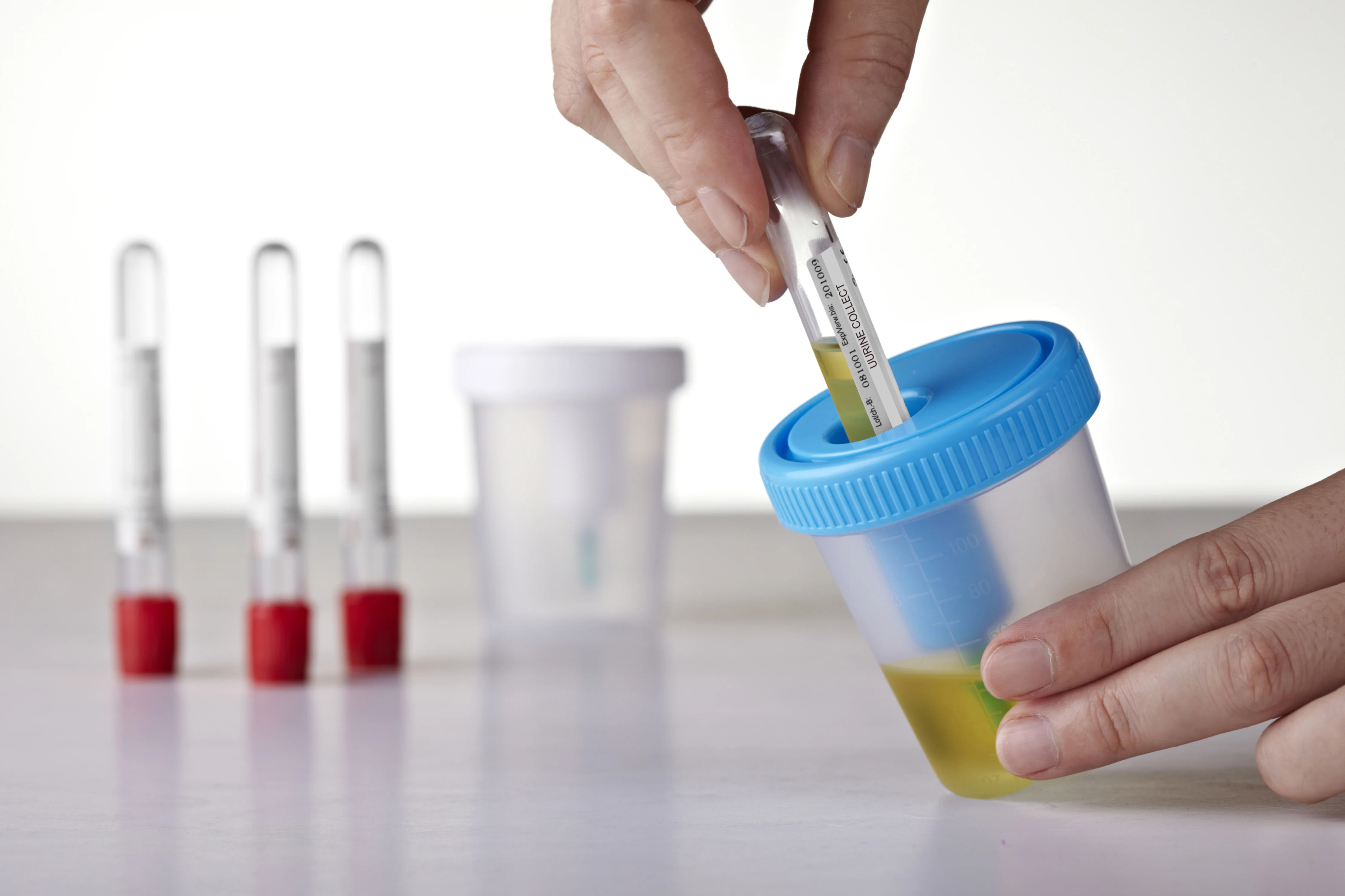 Medical Disposable Urine Sample Container 20ml 40ml 60ml 90ml 100-120ml ...