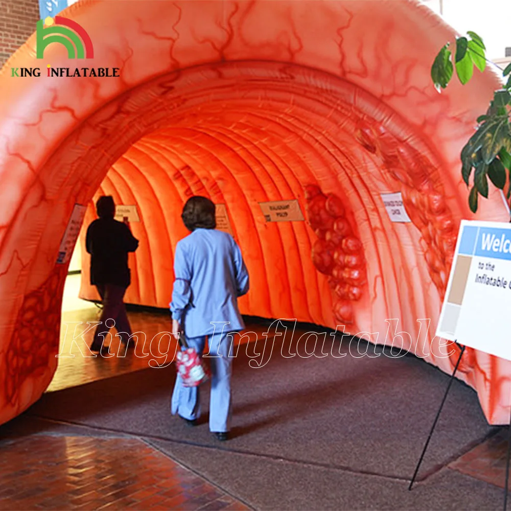 Inflatable Colon - Medical Educational Tool for Cancer Awareness