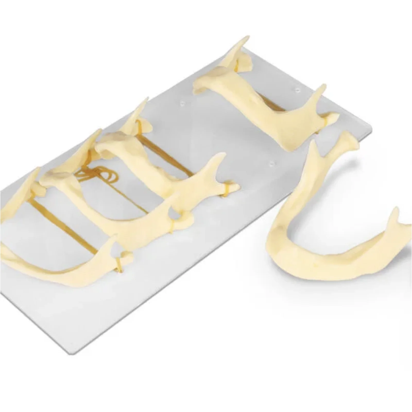 Kyrenmed Atrophied-ridge Mandibular Ble Model Set Of 5 The Development ...
