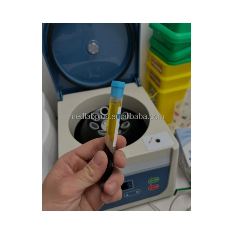 centrigafuga digital centrifuga prf iprf prp machine| Alibaba.com