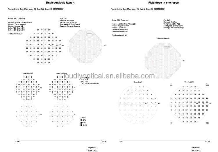 High Quality Visual Field Perimeter - APS-T90 Ophthalmic Instrument
