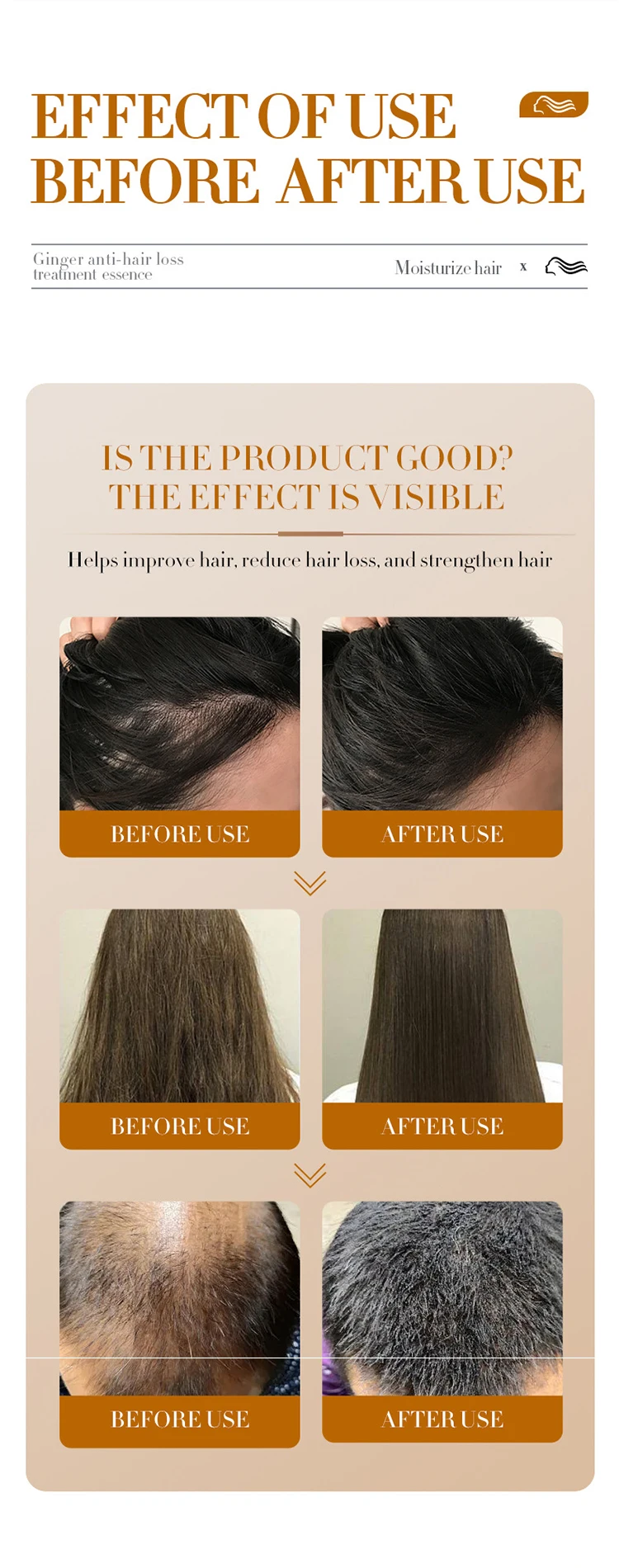 Private Label Natural Organic Vegan Treatment for Bald Hair Serum Pure ...