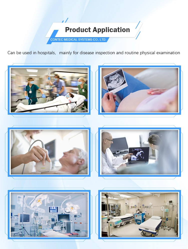 CONTEC CMS1700B Continous Doppler Ultrasound Equipment Ultrasonography ...