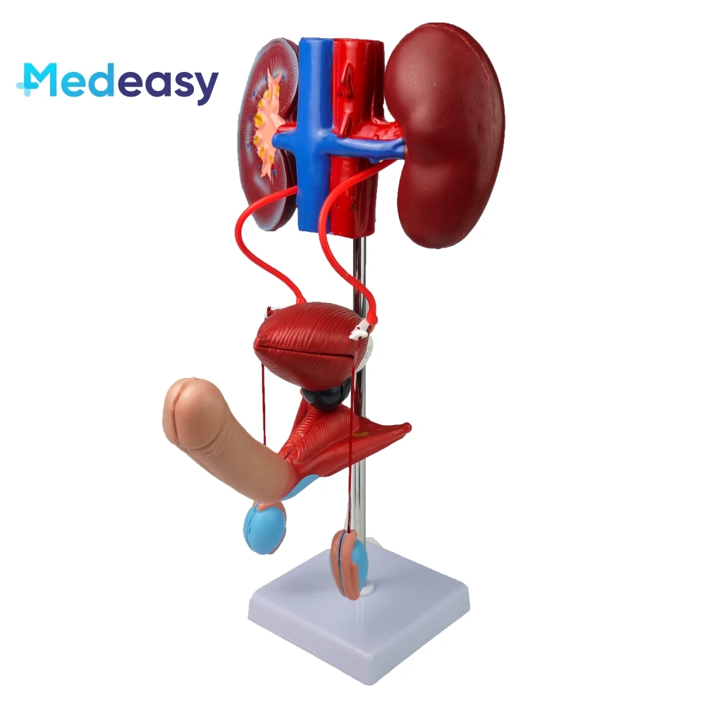 Male and Female Genitourinary System Model, KKdney Anatomy Mold ...