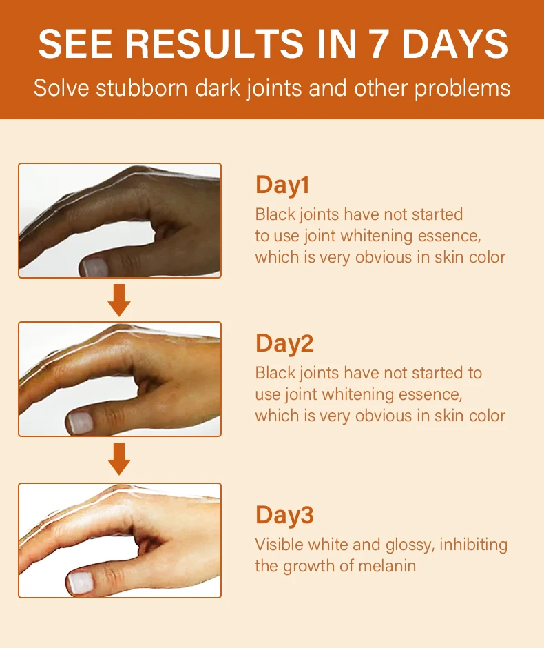 Dark Knuckles Whitening Serum - Intense Stains Remover