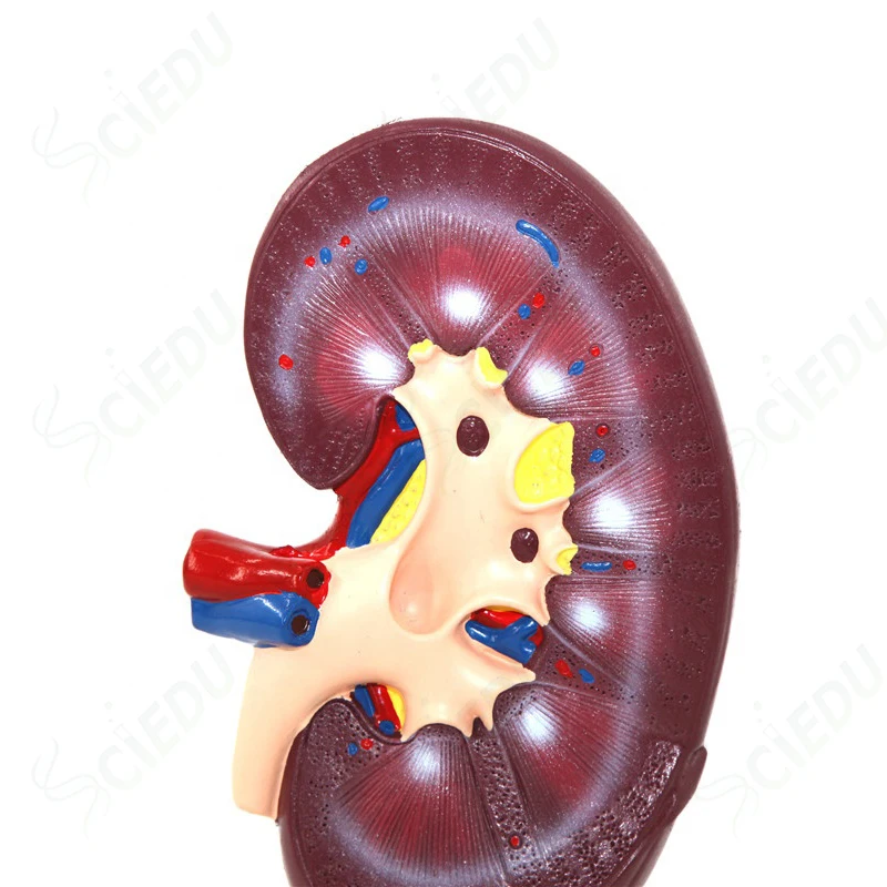 Medical Science Anatomy Kidney Model Teaching Resource Aids Anatomy ...