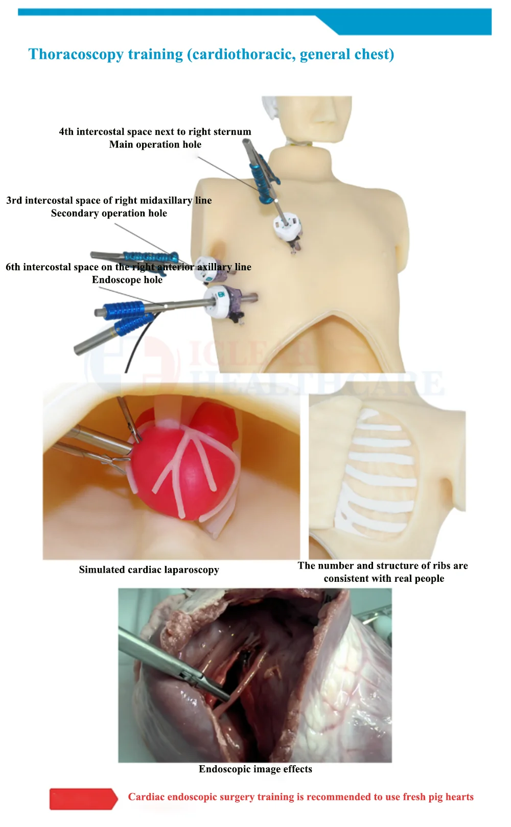 ICLEAR Laparoscopic Simulator - High Simulation Training