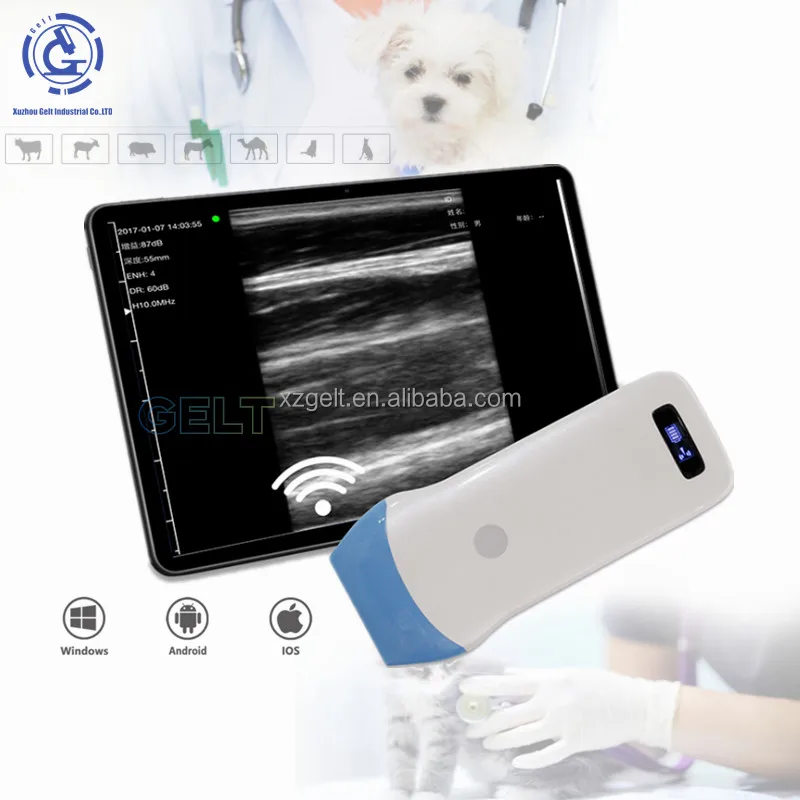Gelt Color Doppler Wireless Linear Ultrasound 192 Elements
