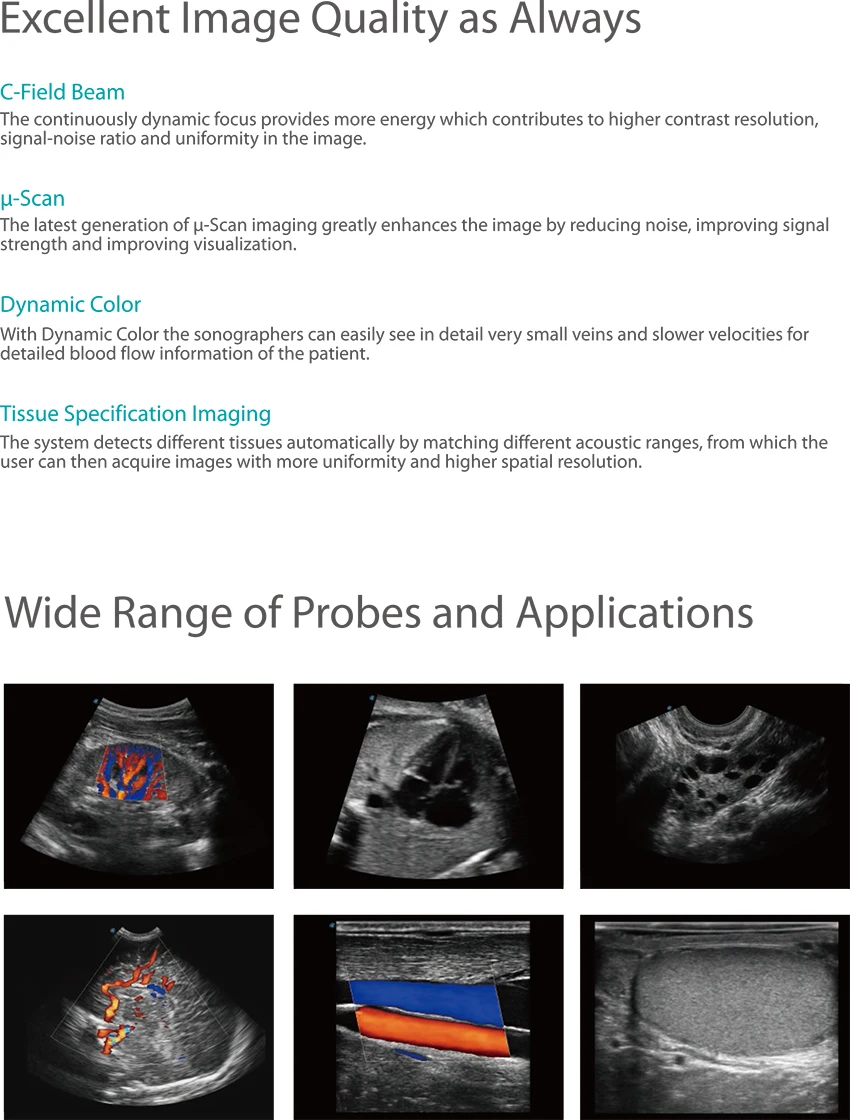 Sonoscape E3 Ultrasound - Advanced 3D/4D Color Doppler