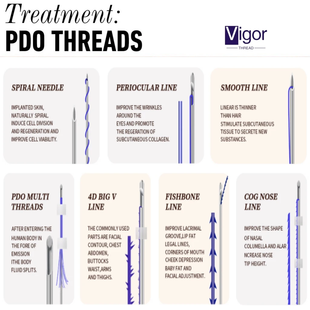 Vigor Thread Tensioners Pdo Korea 4d 6d Cog Thread Cannula Blunt Needle ...