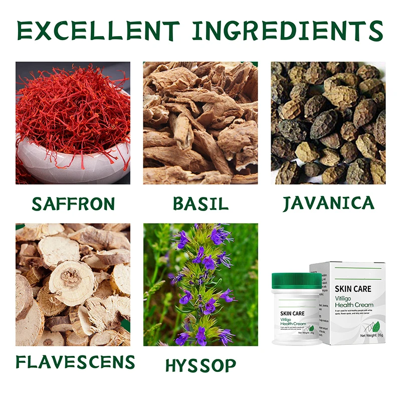 White Spot Vitiligo Treatment Cream Eliminate Desalinate Leukoplakia ...