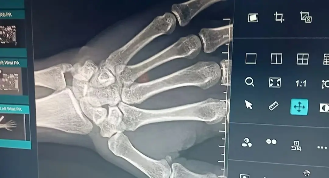 Digital Radiography X Ray Flat Panel Detector For Veterinary Usage X ...