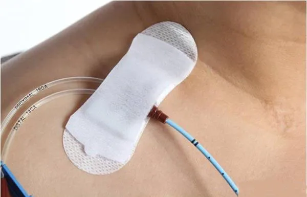 Picc Line Plus Stabilization Device - Cvc Fixation Catheter Holder ...
