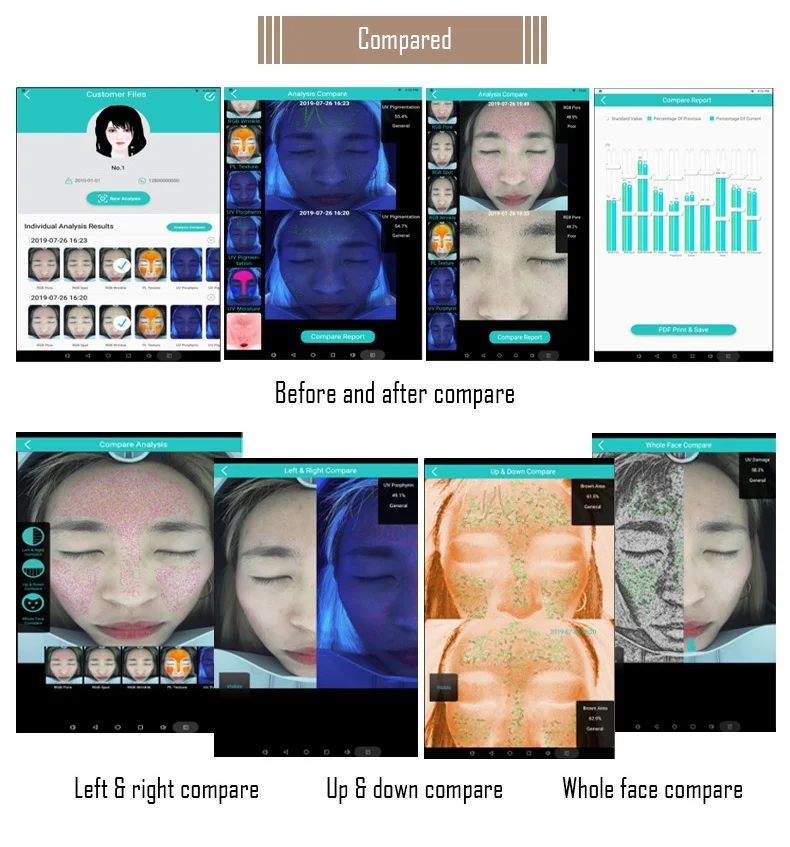 2024 Skin Analyzer Korea 3d Diagnosis System Facial Skin Analyzer Tool ...