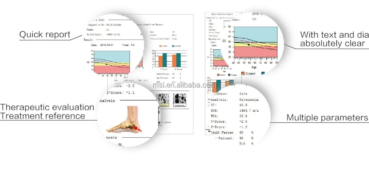 Bone Densitometer - Accurate Ultrasound Bone Diagnostics