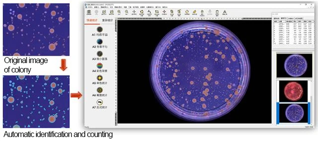 Fully Automatic Colony Counter Analyzer| Alibaba.com
