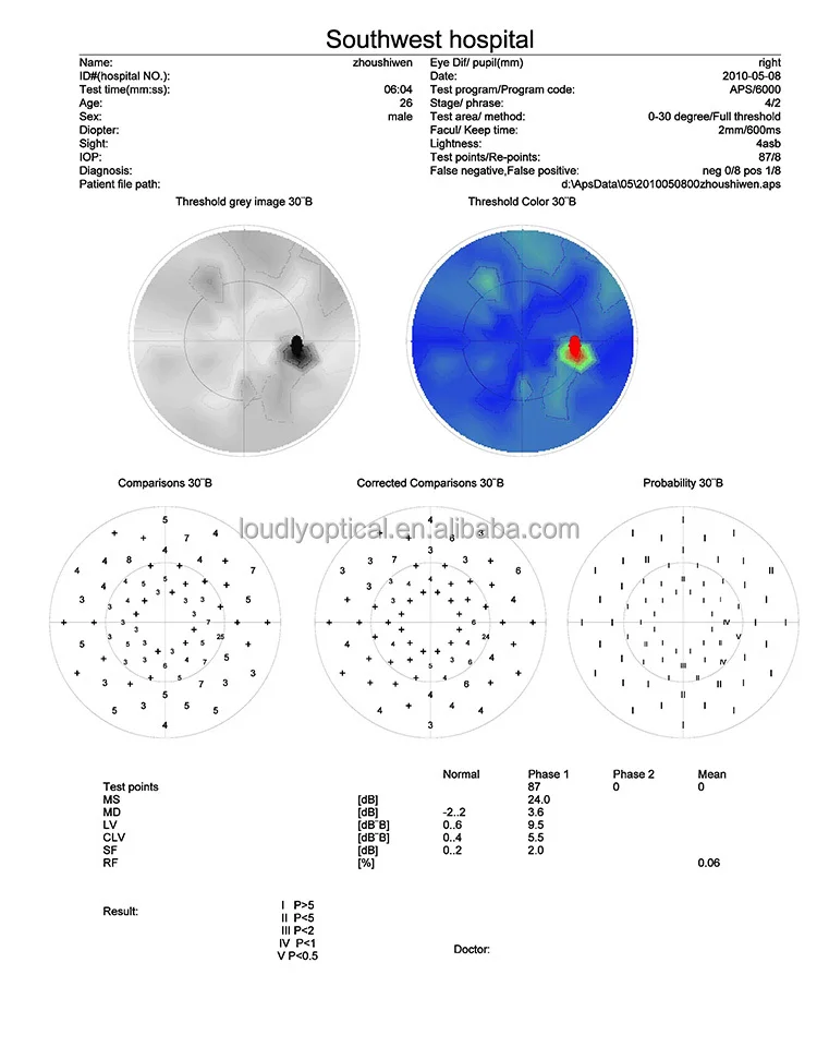 High Quality Visual Field Perimeter - APS-T90 Ophthalmic Instrument