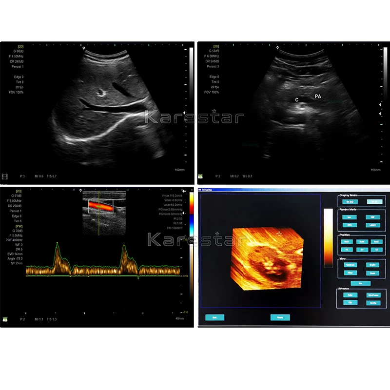 Veterinary Diagnostic Ecografo Color Doppler 3D 4D Scanner
