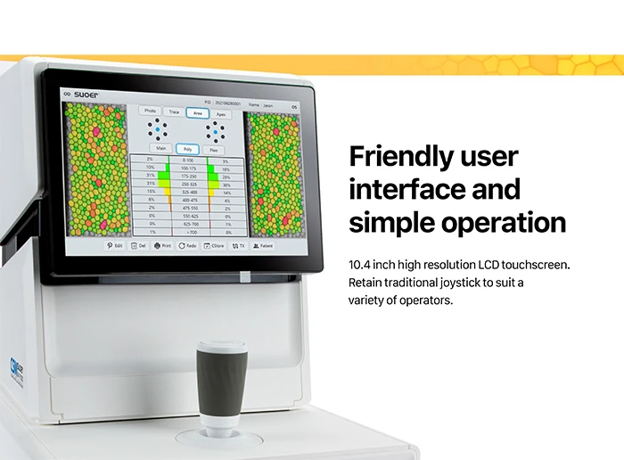 Ophthalmic Equipment Corneal Specular Microscope Endothelial Cell ...