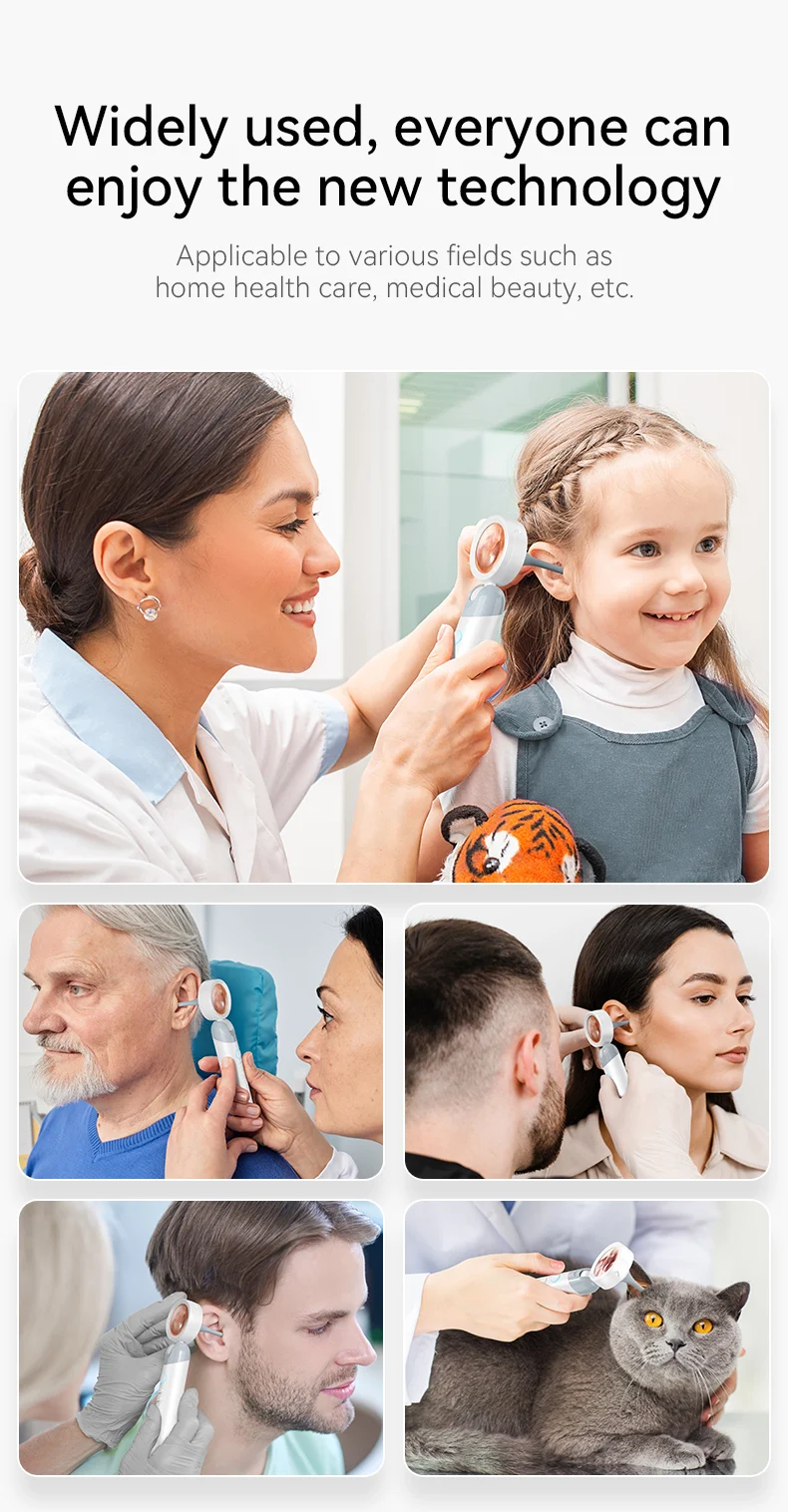 Smart Ear Canal Detector - 1080P Ear Camera for Kids & Pets