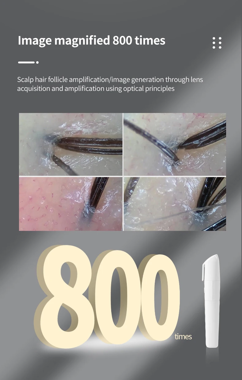 New Skin Analyzer Scalp Hair Camera Scanner Wireless Wifi Connection ...