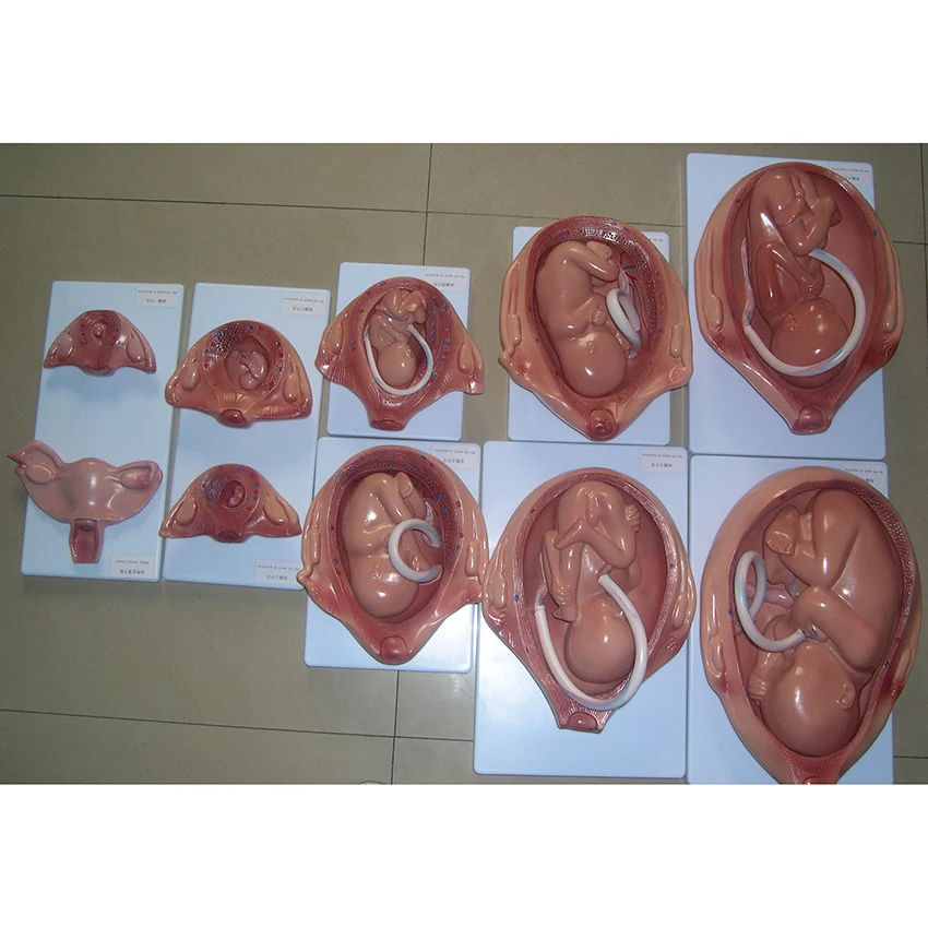 Embryology Anatomical Models,Fourth Month Of Gestation,Uteus Model ...