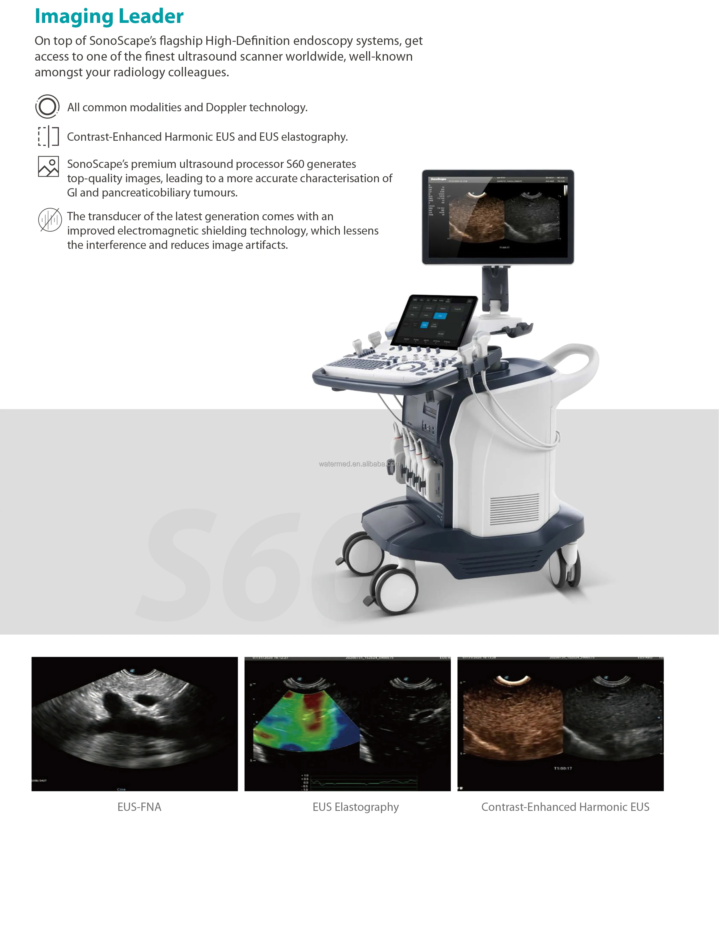 Affordable Sonoscape Ultrasound Endoscopy for Gastrointestinal Imaging ...