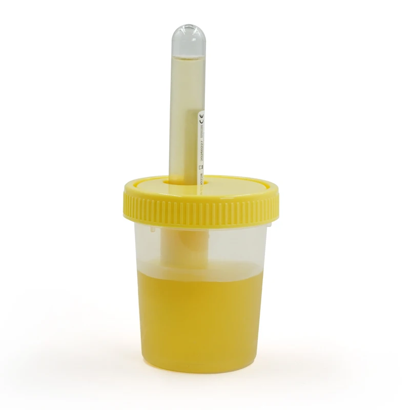 Urine Specimen Container Urine Sample Container Flacon Of Urine - Buy ...