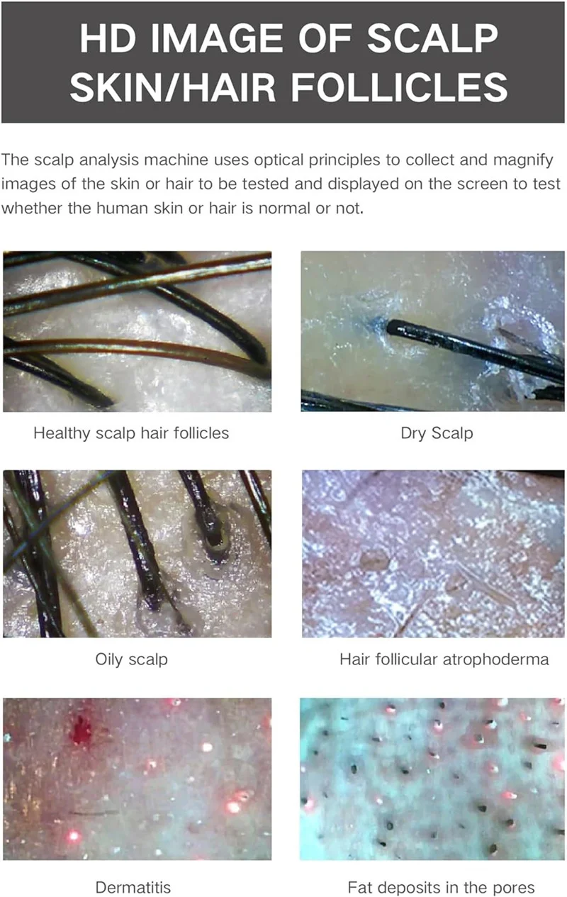 ZS 11 Inch Scalp/Skin/Hair Analyzer Detector Digital UV Testing ...