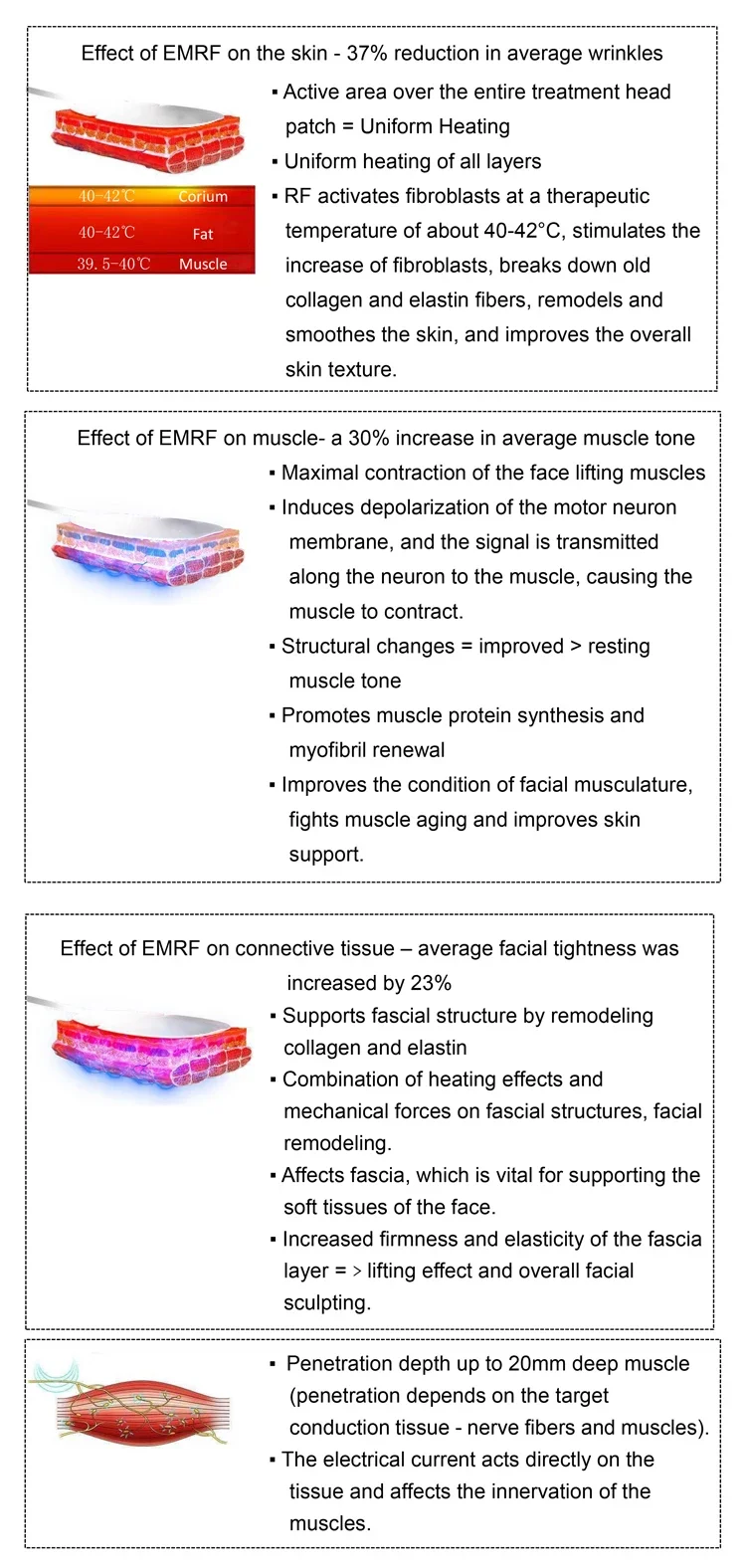 Emrf Microcurrent Hot Selling Skin Tightening Muscle Stimulator Rf Face ...