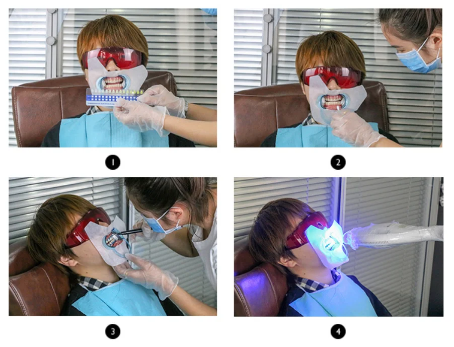 1.5ml Gingival Gum Blue Protection Barrier Gel for Teeth Whitening