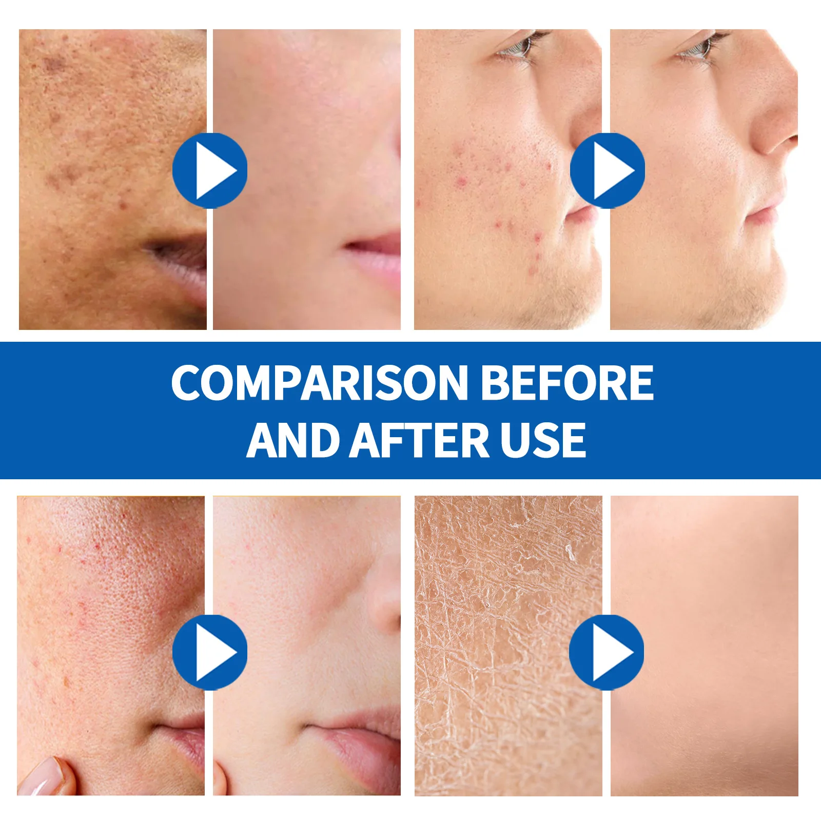 East Moon Oem Odm For Men Face Care Deeply Moisturizing Nourishing Skin ...