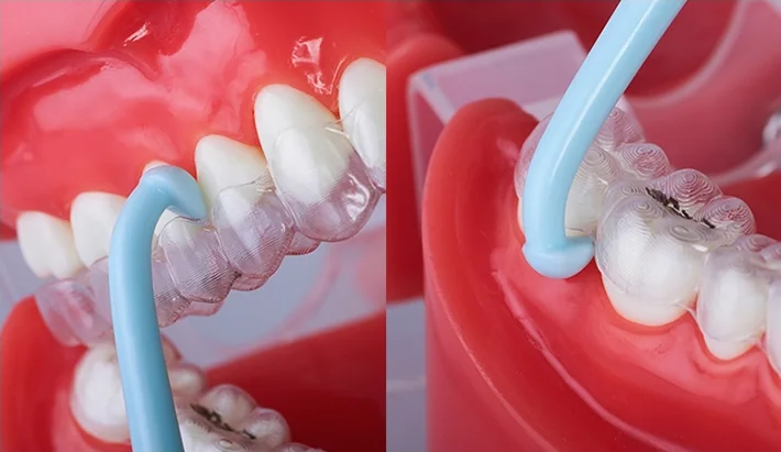 Dental Orthodontic Aligner Seater Chewies for Invisalign Trays Aligner ...