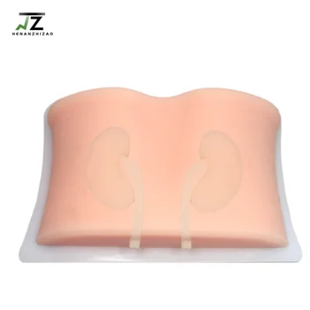 Medical Science Kidney Puncture Model Guided By Ultrasound For Training ...
