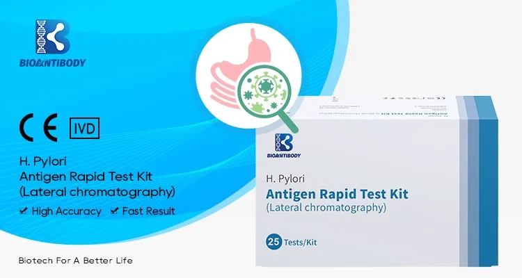 H. Pylori Antigen Antibody Hp Rapid Test Kits For Self Test - Buy H ...
