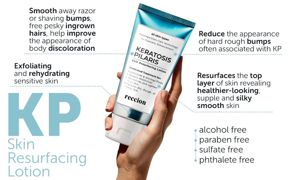 Strawberry Legs Kp Ingrown Hair Treatment Bumpy Skin Body Lotion ...