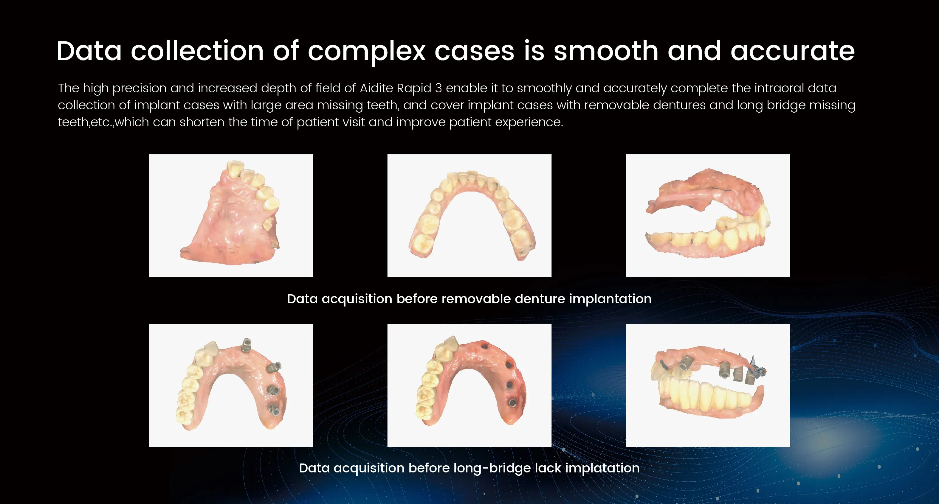 Aidite Intraoral Dental Ceramic 3D Scanner - Reliable 3D Dental Imaging ...