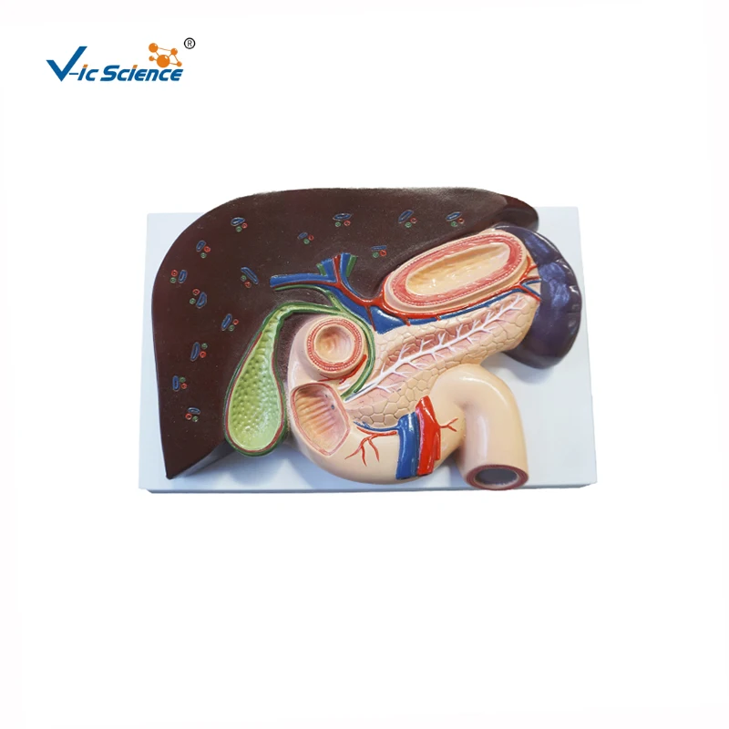Anatomical Pancreas Model Liver With Gallbladder Pancreas And Duodenum ...