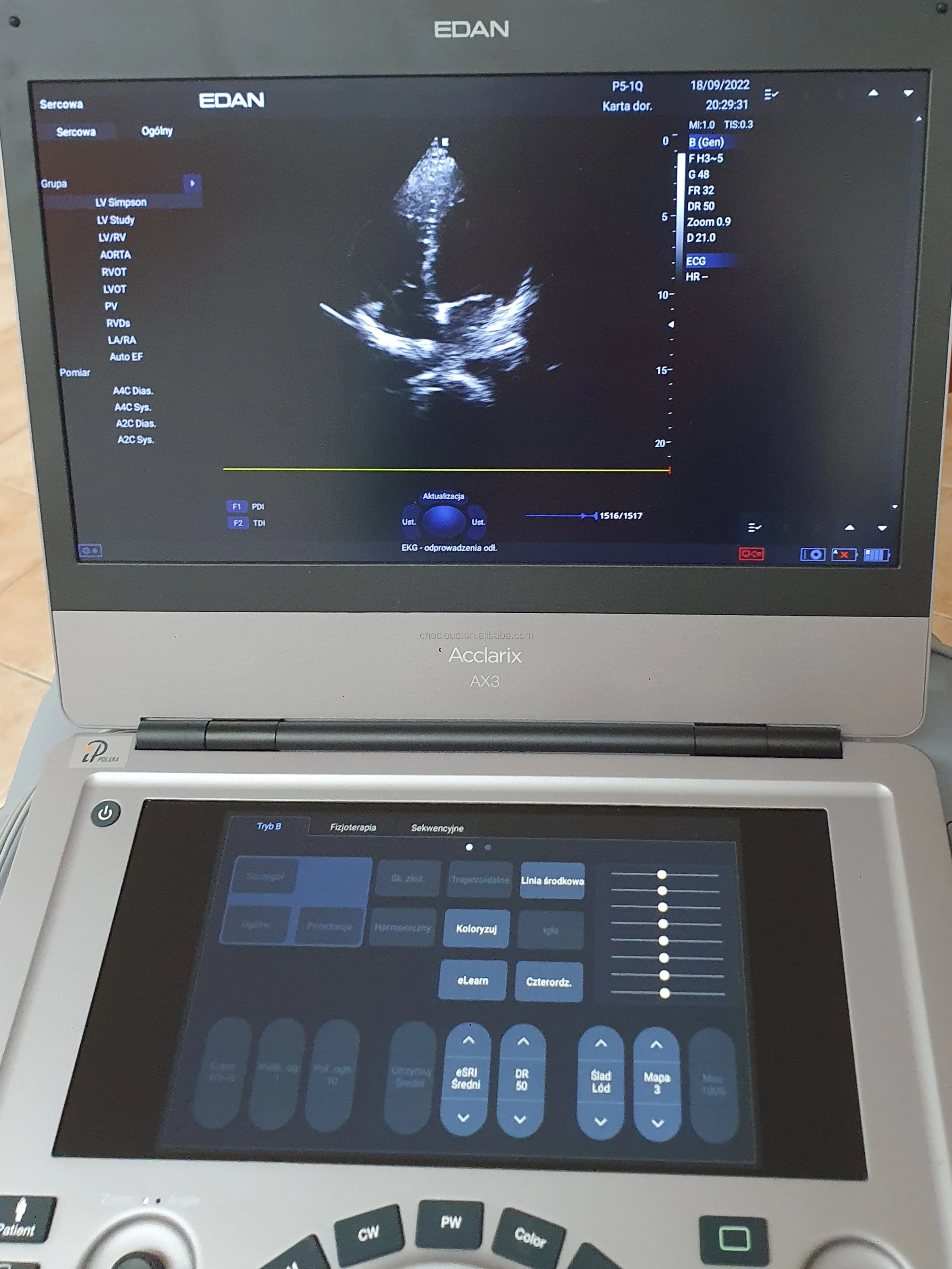 Edan Ultrasound Machines - Reliable and Affordable Solutions