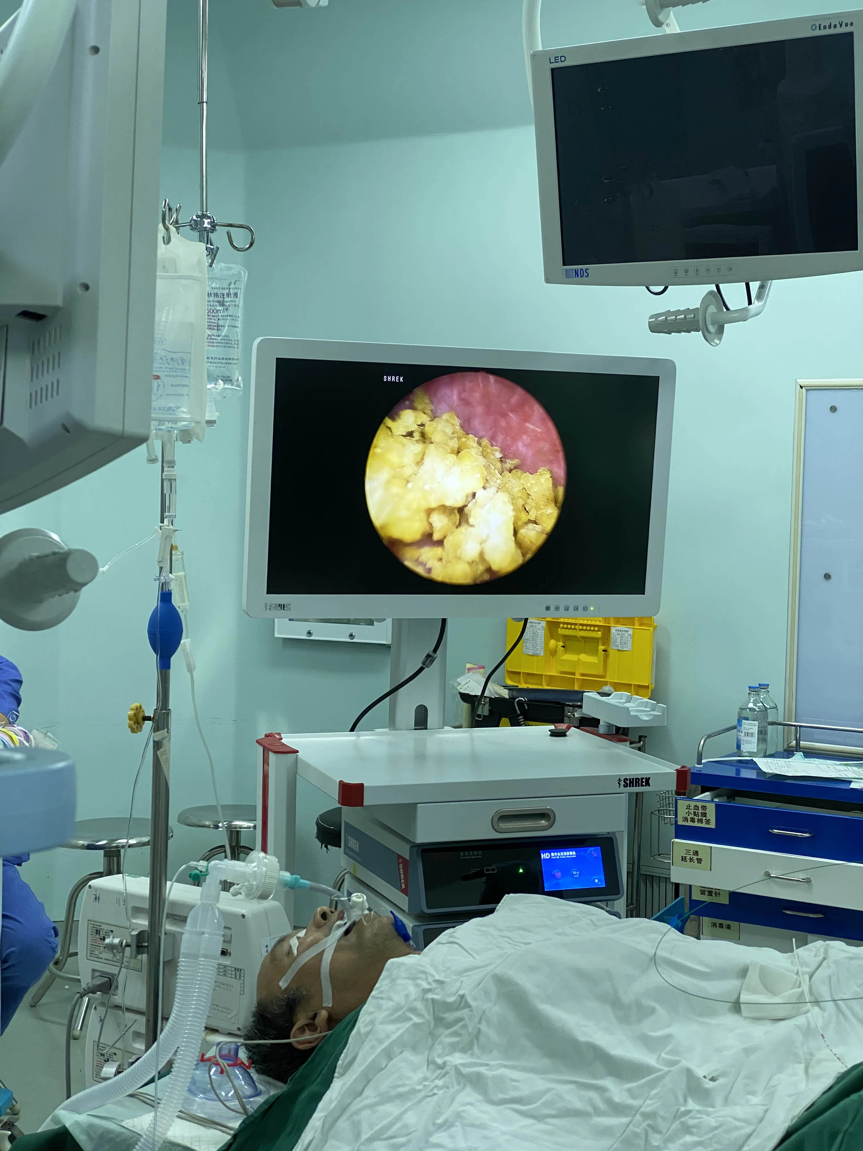 4k Medical Imaging Monitor 3840x2160 Uhd Endoscope Surgery Monitor ...