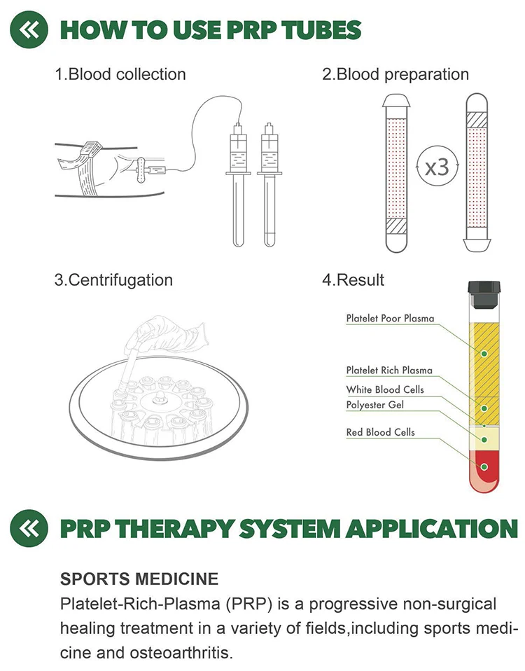 Medical Prp Kit Korea 8ml/ 10ml/ 12ml/ 15ml/ Sodium Citrate Separating ...
