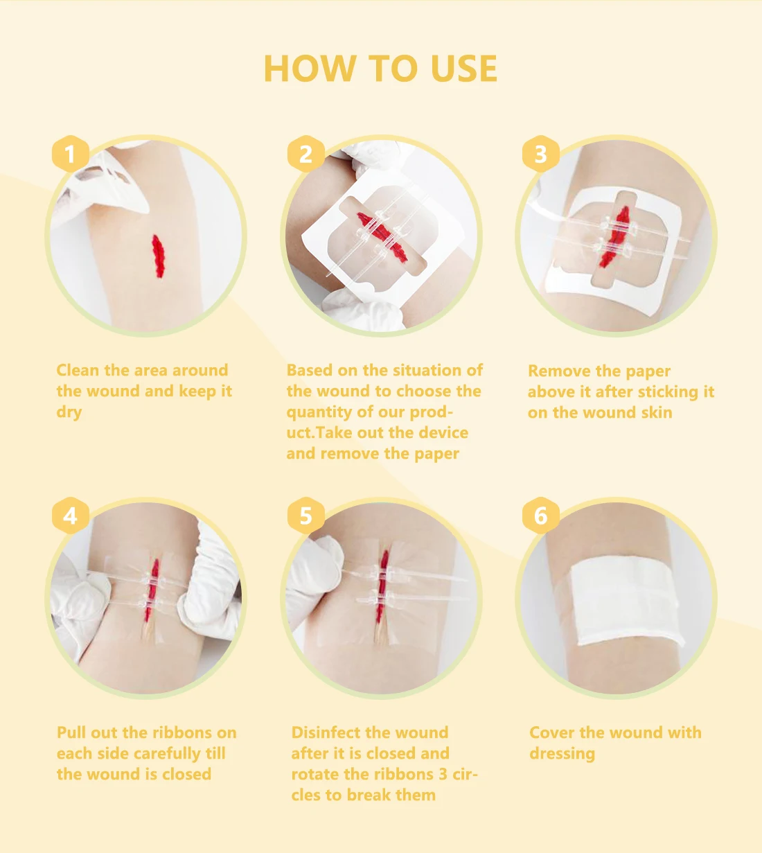 BLUENJOY Wound White Wound Closure Sterile Easy to Use for Reducing ...